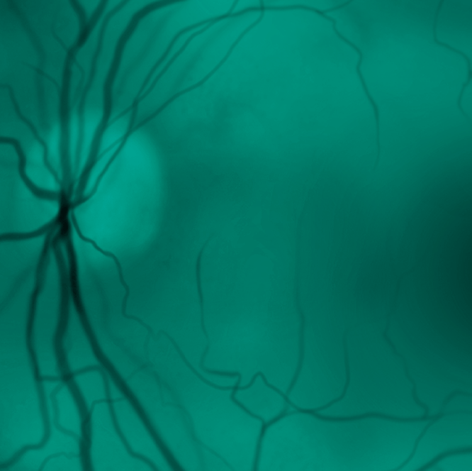 Ophthalmology - Merck.com